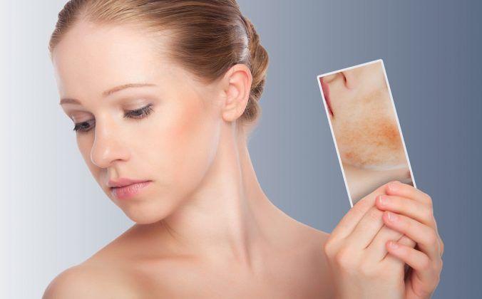 Disimular las imperfecciones de la piel si es posible - Famosas.es